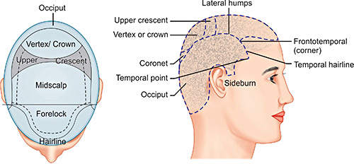 About Hair Loss | Tir na nÓg Clinic - Hair Restoration, Medical and ...